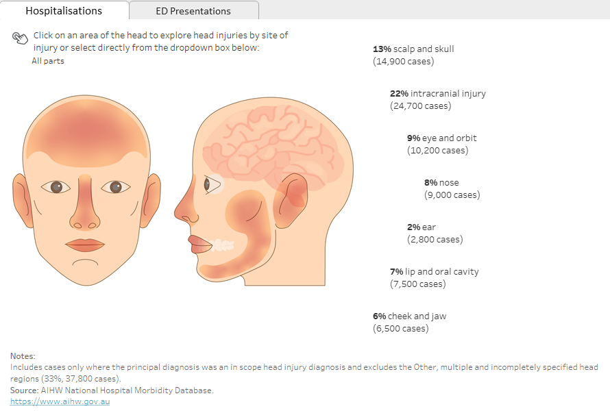 Head injuries in Australia 2020–21, Site of head injury - Australian ...
